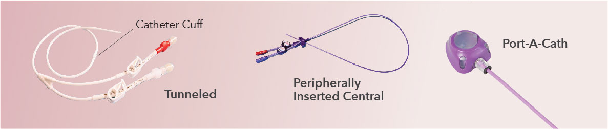 Non Tunneled Central Venous Catheter